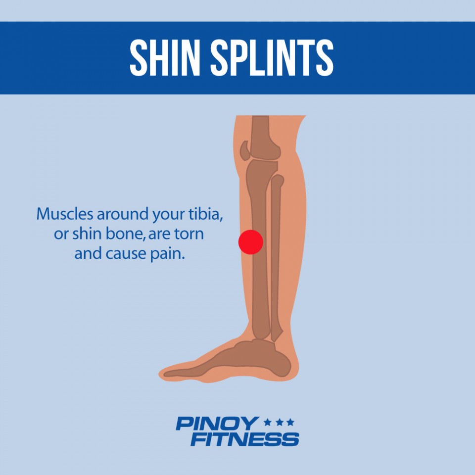 7 Common Running Injuries and What You Can Do About Them | Pinoy Fitness