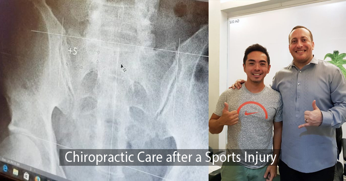 Chiropractic Care after a Sports Injury | Pinoy Fitness